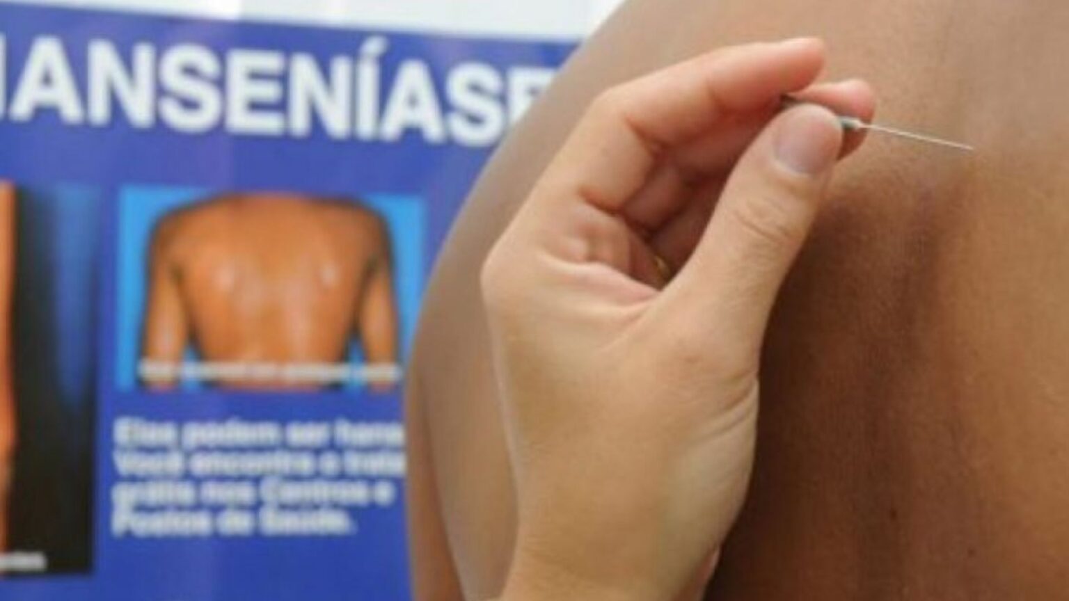Tratamento contra doença envolve diversos procedimentos. Imagem ...