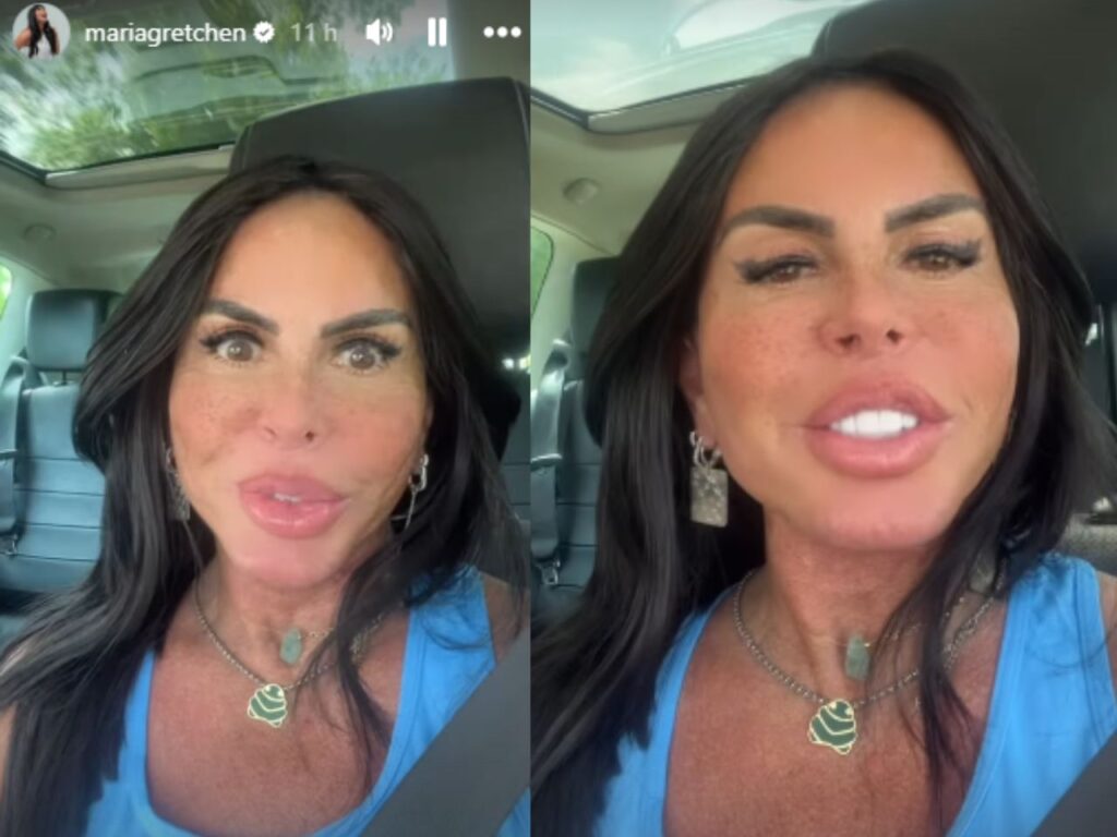 Aos 66 anos, Gretchen mostra resultado de nova harmonização e esbanja ...